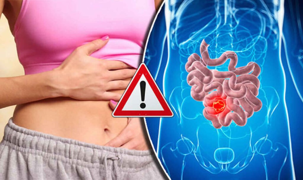 Fecal Impaction Causes and Treatment - Dr AvinashTank, is a super ...