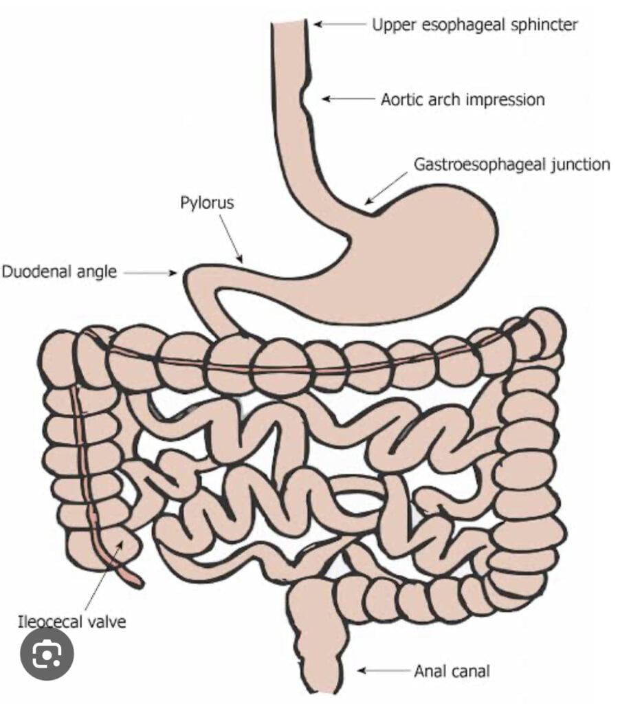 Foreign Bodies and Small Bowel Obstruction: Causes, Symptoms, and ...