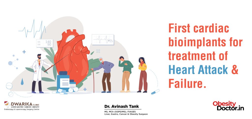 First cardiac bioimplants for treatment of Heart Attack & Failure. - Dr ...