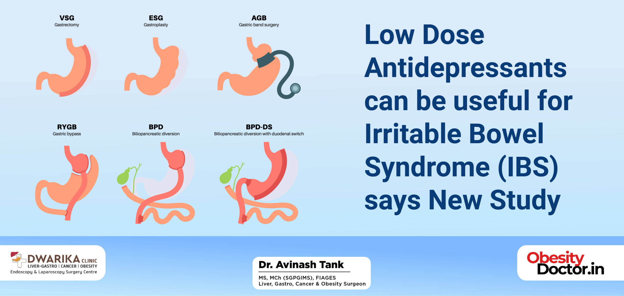 Low Dose Antidepressants can be useful for Irritable Bowel Syndrome ...