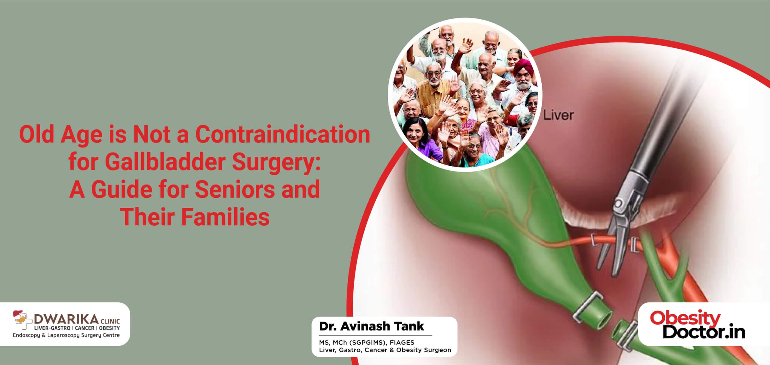 Old Age is Not a Contraindication for Gallbladder Surgery: A Guide for ...